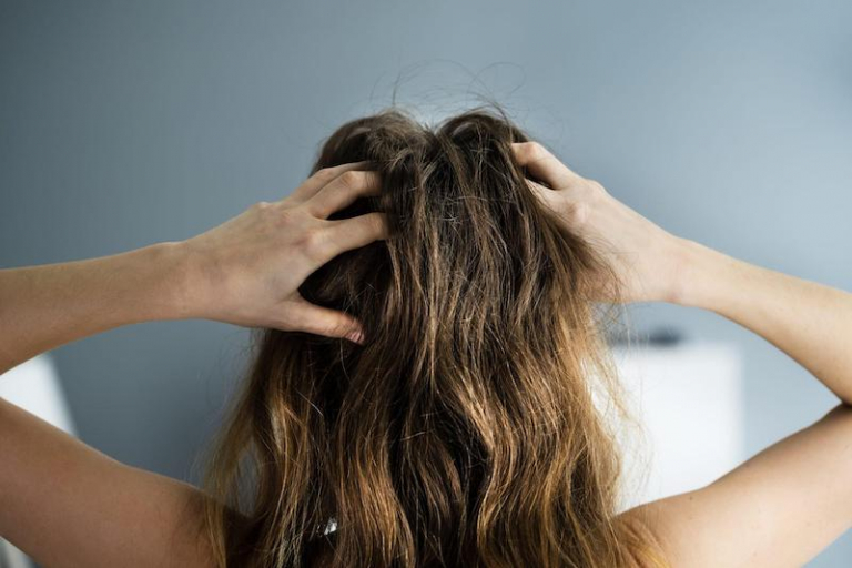 Cause della perdita di capelli tra le donne e le cure - Archzine.it